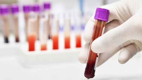 Develop New Cancer Detection Tool – Asian Fund for Cancer Research